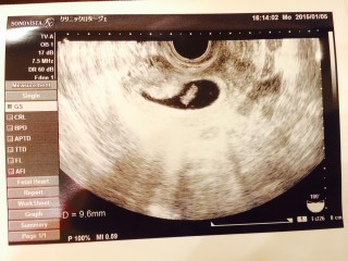 妊娠5w3dのエコー写真(ページ3)