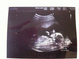 妊娠14週5日(14w5d)の超音波(エコー)写真