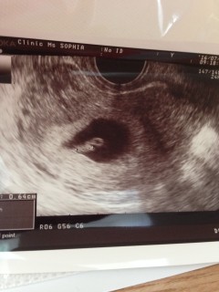 妊娠6週5日(6w5d)の超音波(エコー)写真