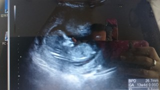 妊娠13週4日(13w4d)の超音波(エコー)写真