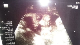 妊娠33週0日(33w0d)の超音波(エコー)写真