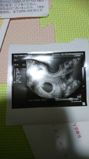 妊娠5週3日(5w3d)の超音波(エコー)写真