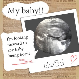 妊娠14週5日(14w5d)の超音波(エコー)写真