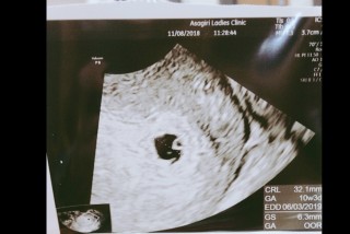 妊娠5週3日(5w3d)の超音波(エコー)写真