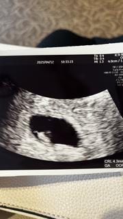 妊娠5週3日(5w3d)の超音波(エコー)写真